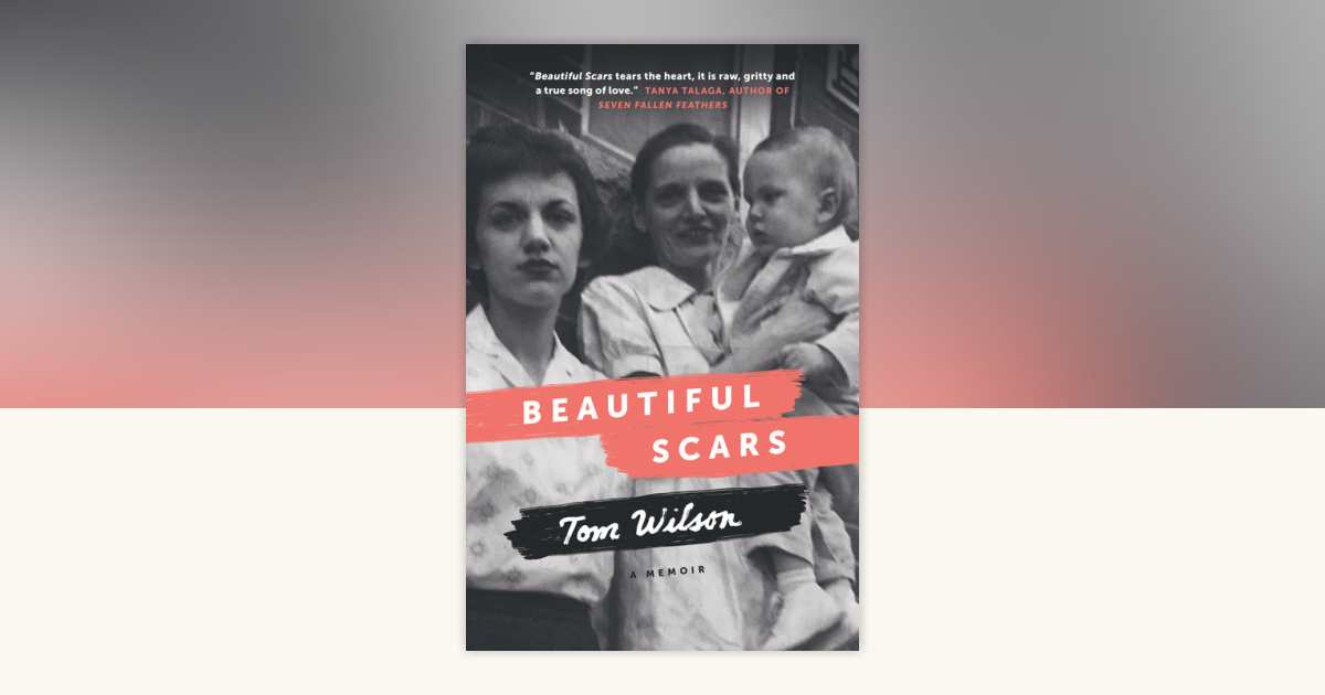 Beautiful Scars by Tom Wilson: 9780385685672 | PenguinRandomHouse.com ...